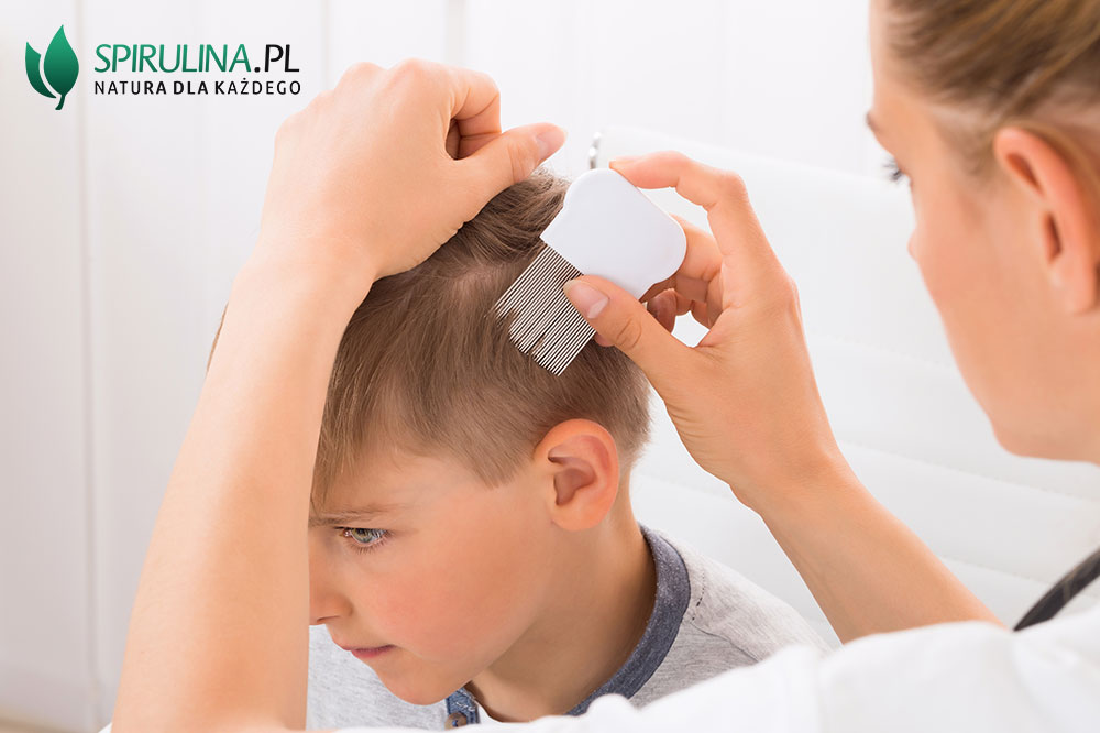 Jak wytępić wszy? - algi Spirulina i Chlorella