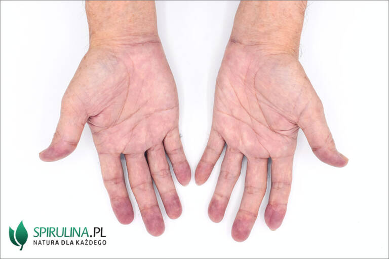 Sinica - algi Spirulina i Chlorella