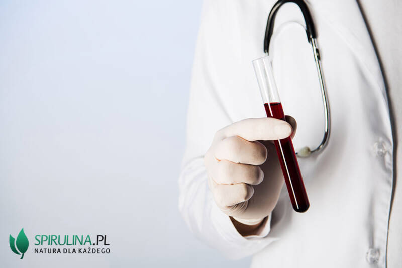 Hematolog - algi Spirulina i Chlorella