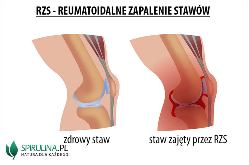 RZS - algi Spirulina i Chlorella