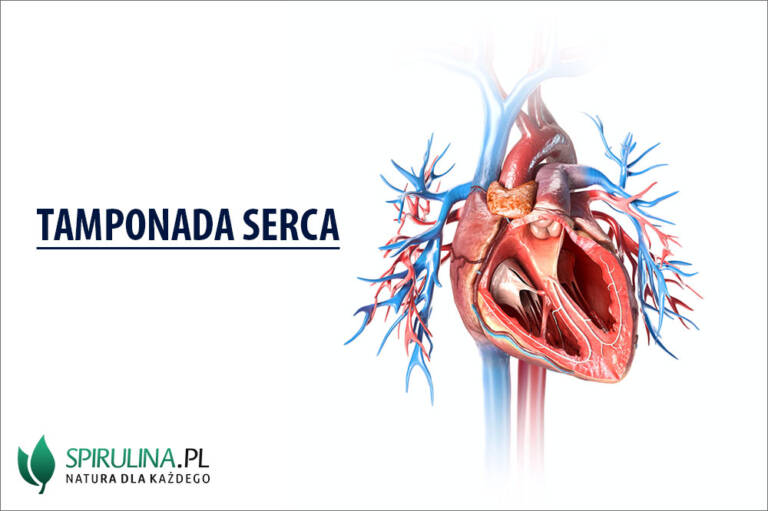 Tamponada serca - algi Spirulina i Chlorella