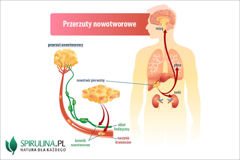 Przerzuty nowotworowe - algi Spirulina i Chlorella