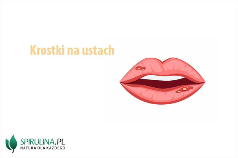 Krostki na ustach - algi Spirulina i Chlorella