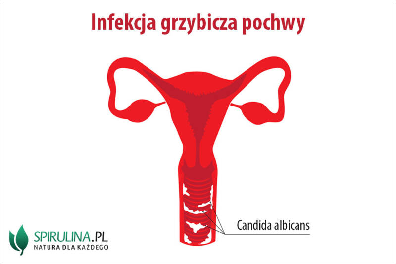 Infekcja grzybicza pochwy - algi Spirulina i Chlorella