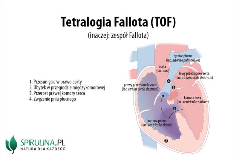 Tetralogia Fallota - algi Spirulina i Chlorella