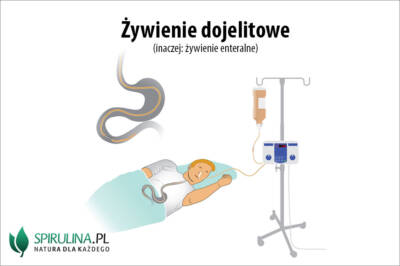 Żywienie dojelitowe - algi Spirulina i Chlorella